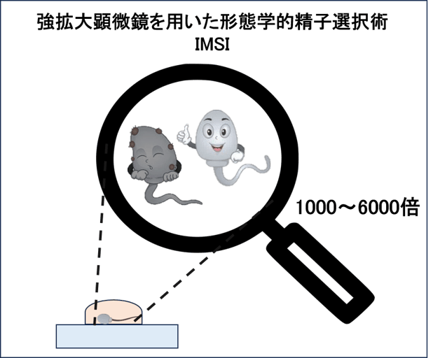 ICSI(顕微授精)に使用するPVPについて