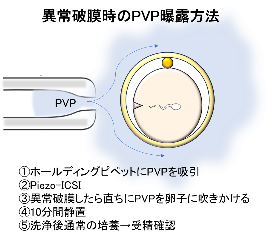 ICSI(顕微授精)に使用するPVPについて